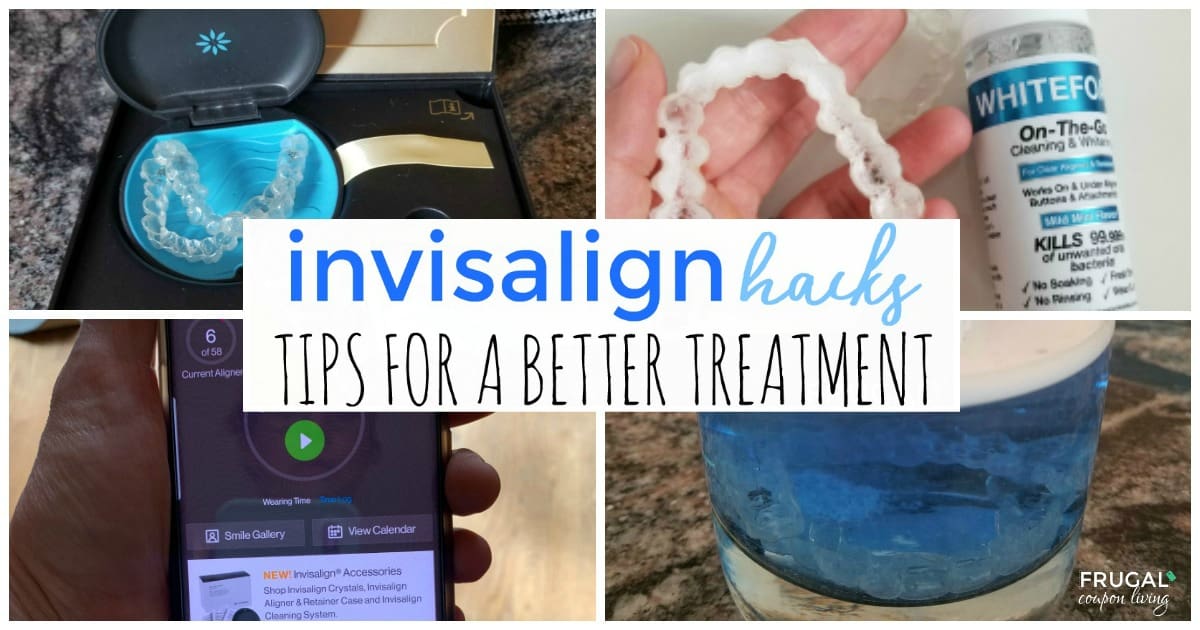 16 Invisalign Hacks and Tips To Make Your Treatment Better